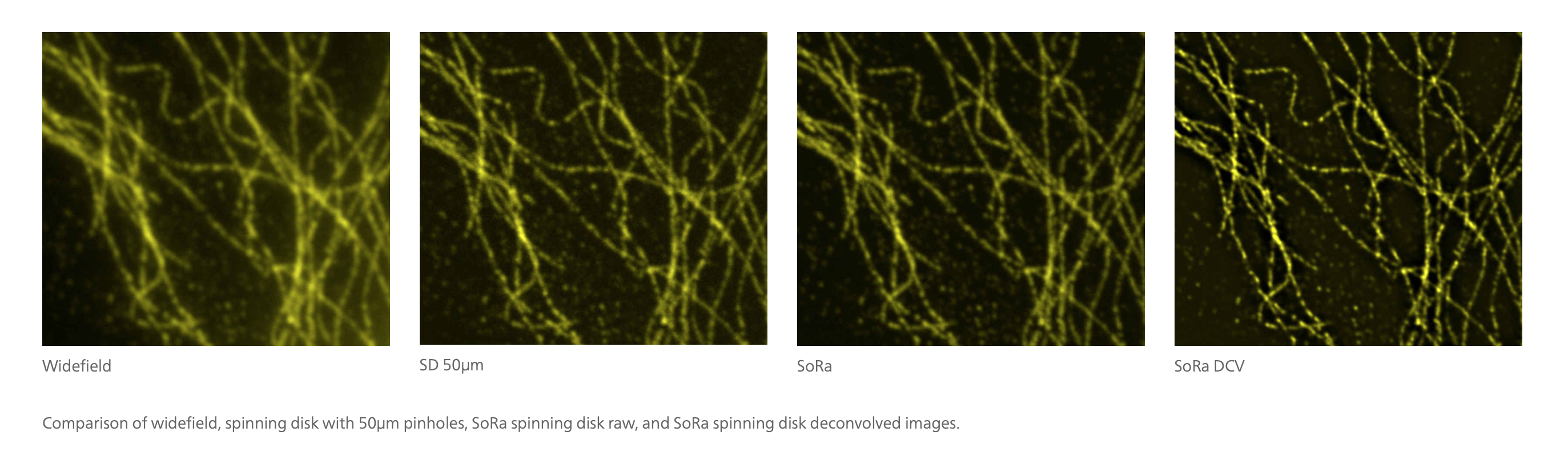 Nikon SoRa Spinning disk confocal – GIIF